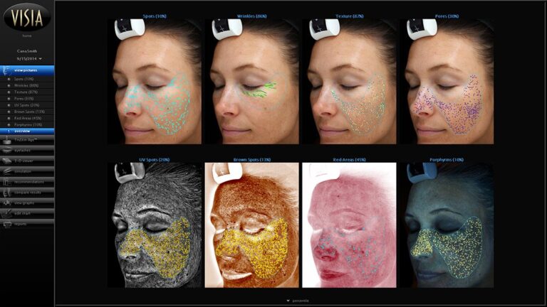 VISIA Skin Analysis - Desert Eyesthetics